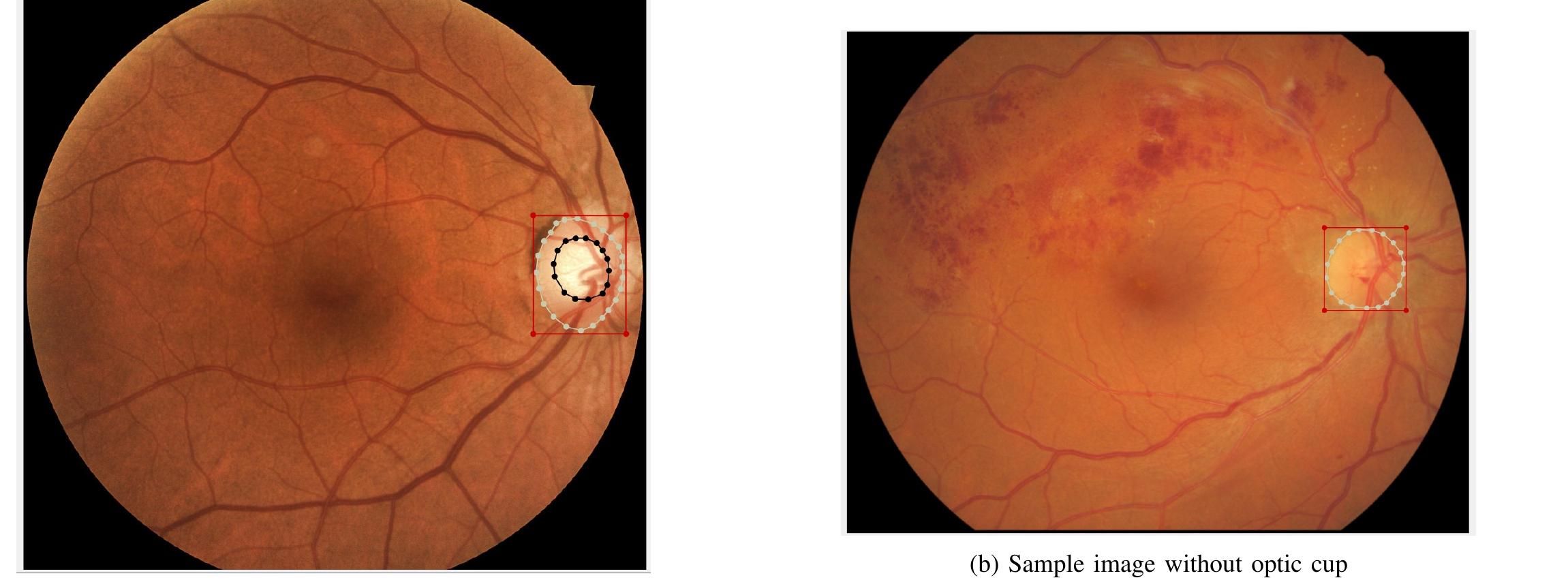 Sample images with optic cup (black polygon), optic disc