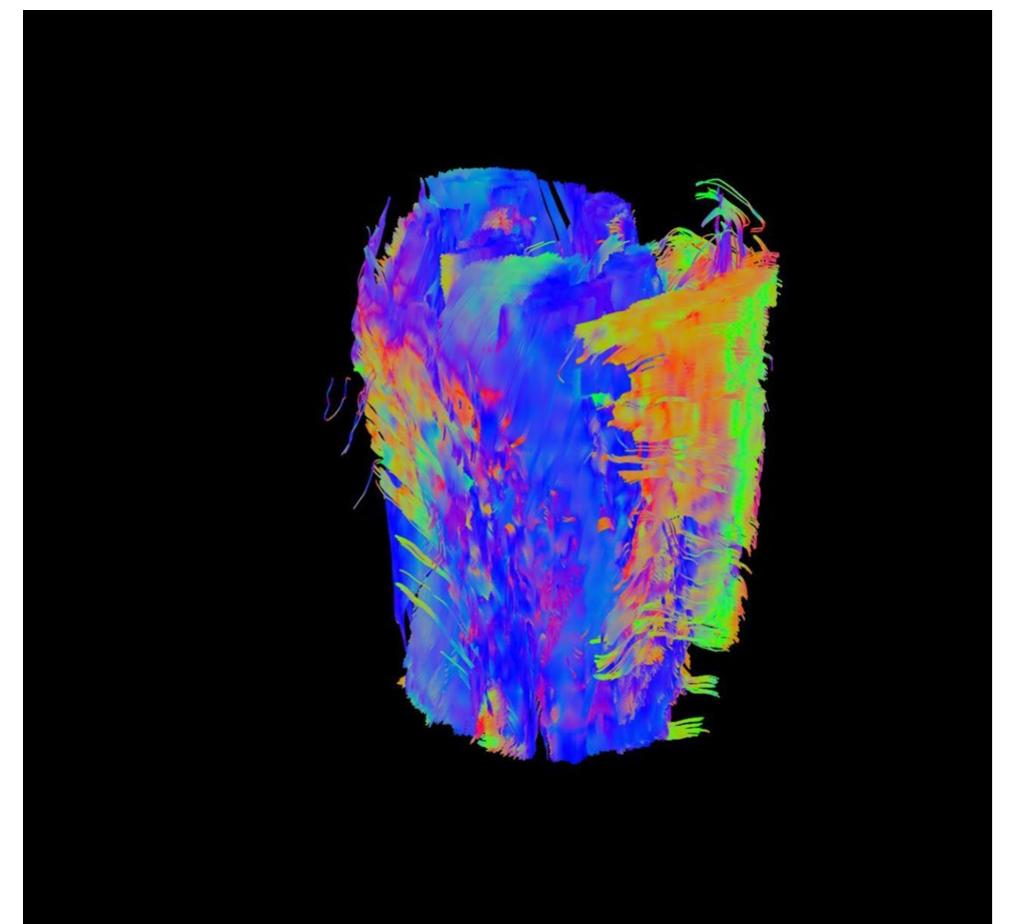 Mri-dti of skeletal muscle. image showing a _ posterior view