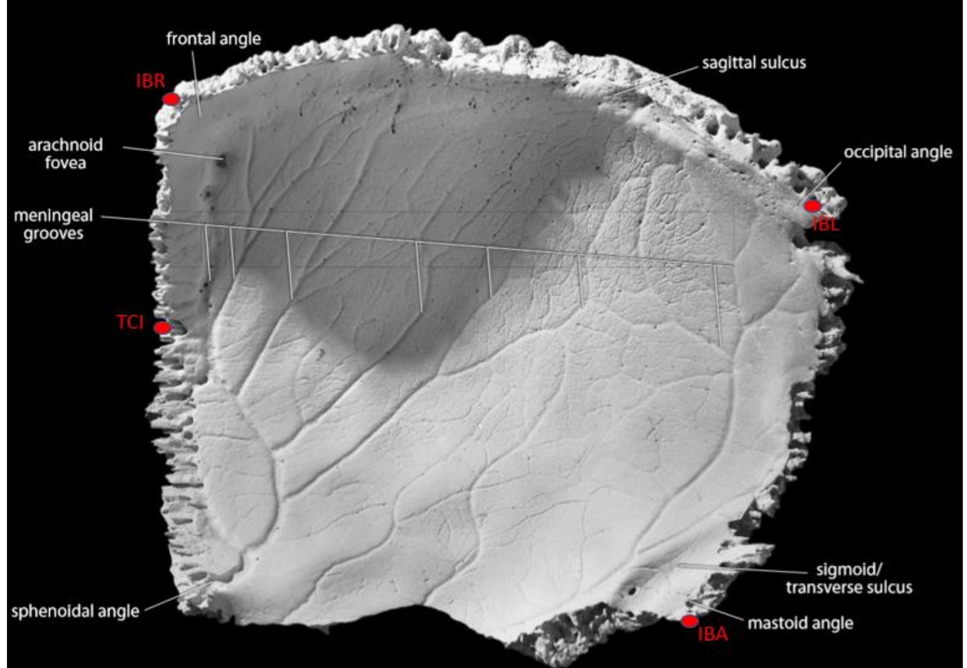 B.26. parietal, medial; photograph adapted from white et al.