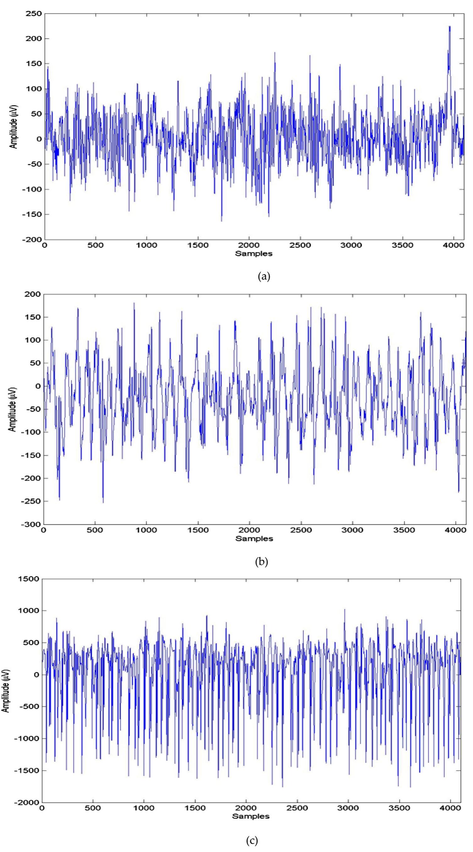 Typical eeg signals: (a) normal, (b) interictal and (c)