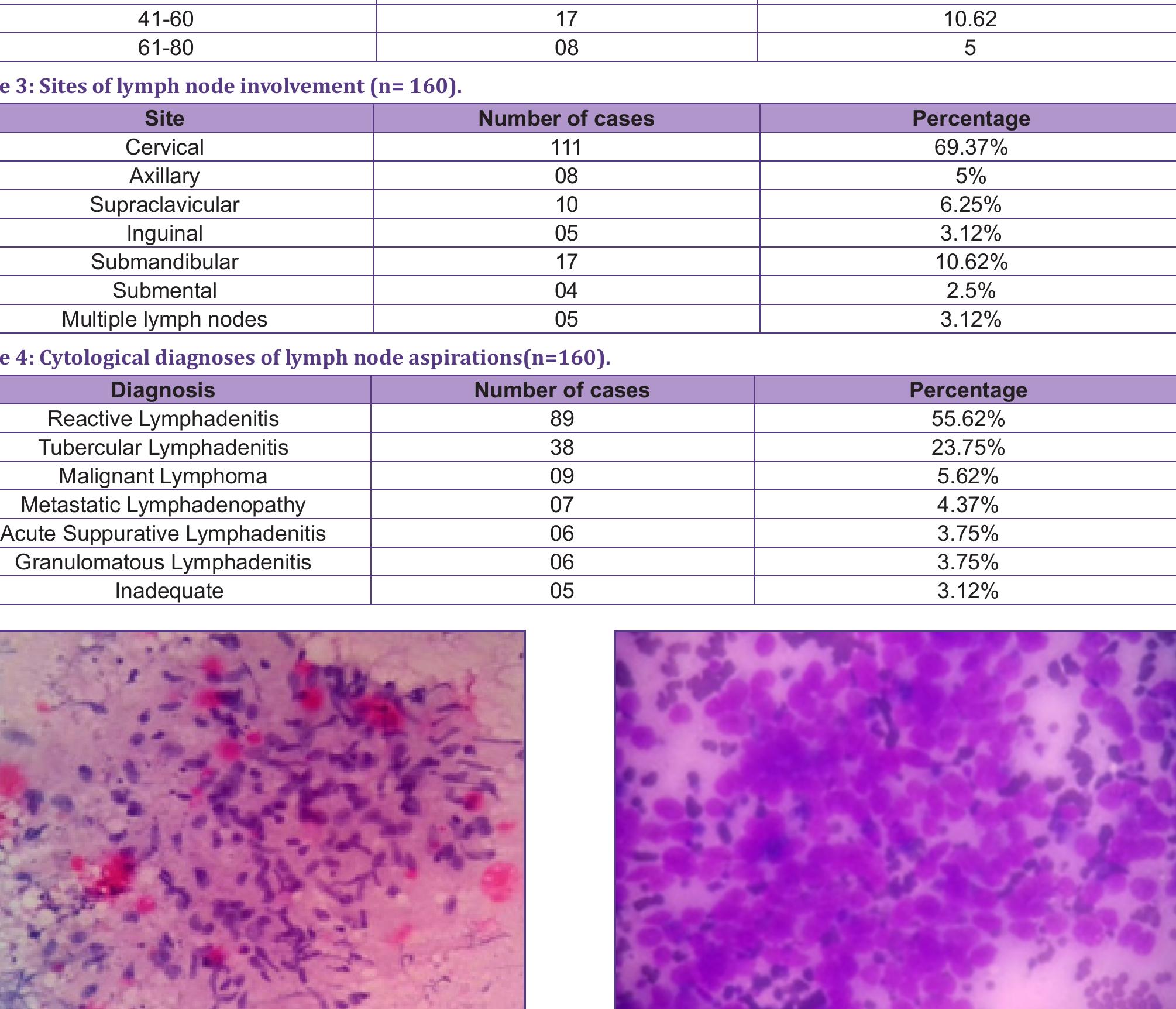 Table 3 - Spectrum of Lymph Node Lesions by Fine Needle