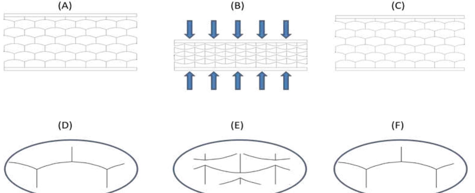 A negative stiffness mesostructure (a and d), capable of