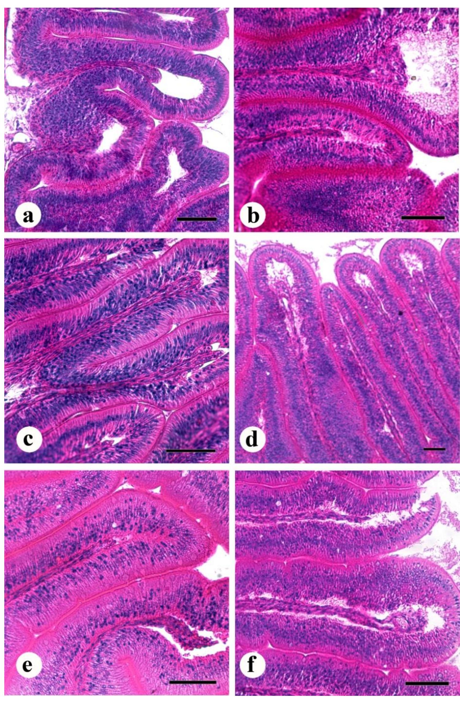 (5): histomorphology of nile tilapia intestine (a) control