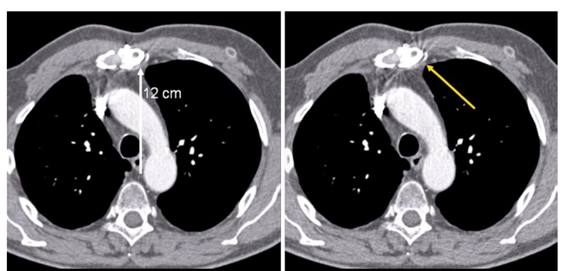 12. demonstration of z-axis resolution for a mdct system