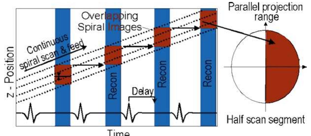 15. principle of retrospectively ecg-gated spiral scanning