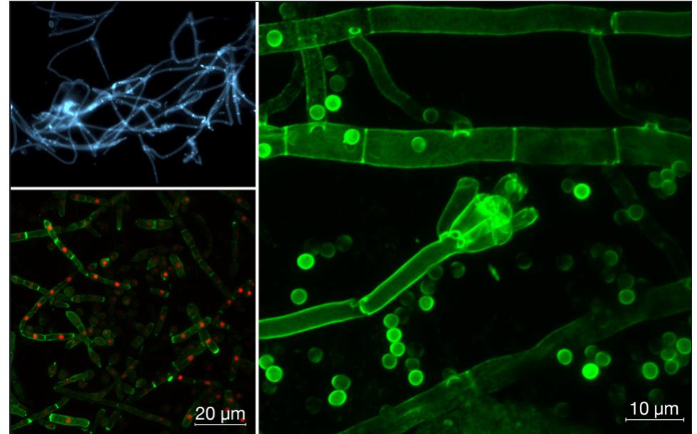 Photographs of epifluorescence microscopy of an environ-