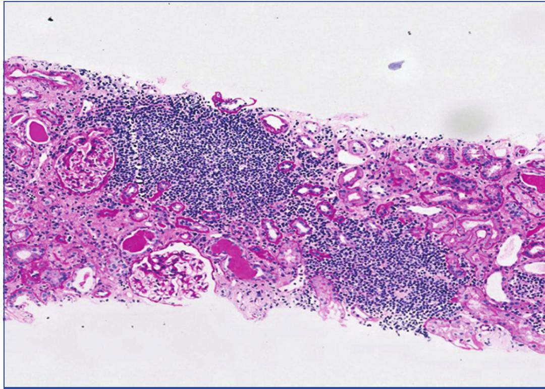 [table/fig-1]: pas (10x) magnification showing normal