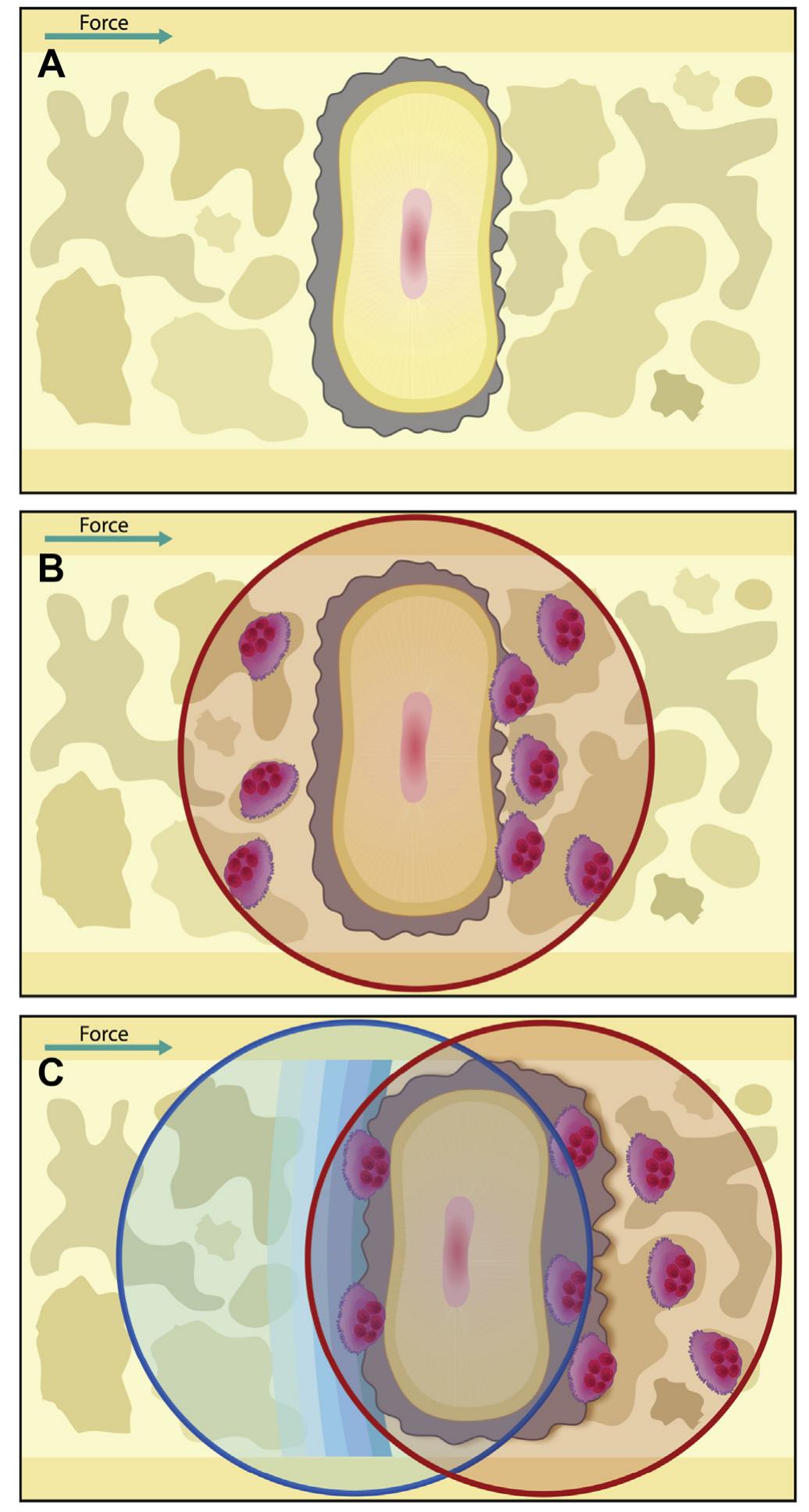 Schematic of biphasic theory of tooth movement. the biologic