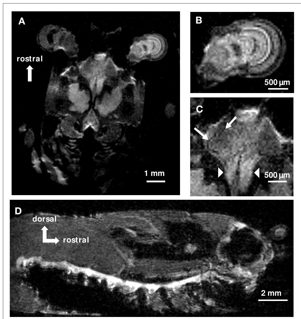 Figure 2 - Non-Invasive Imaging of Neuroanatomical