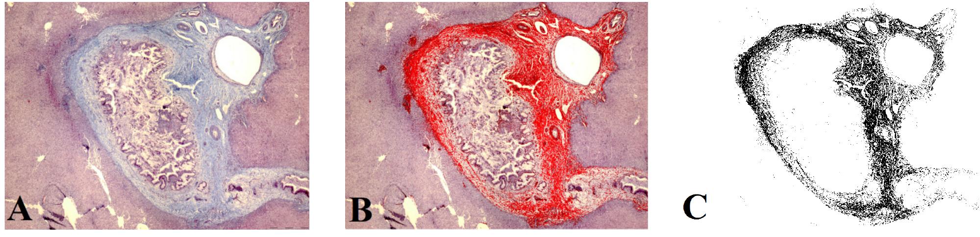 The first method of image processing: the micrograph with