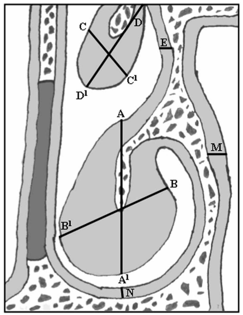 Schematic diagram illustrating how the mucosal area of the
