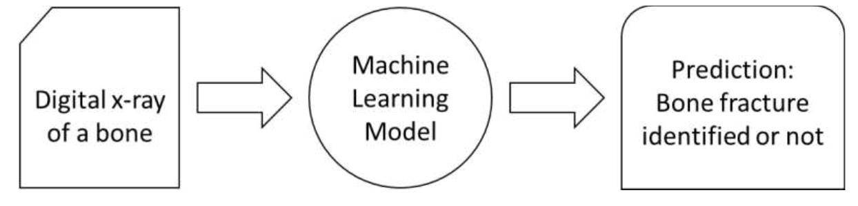 Figure 1 Bone Fracture Detection Using Ml Bone Fracture