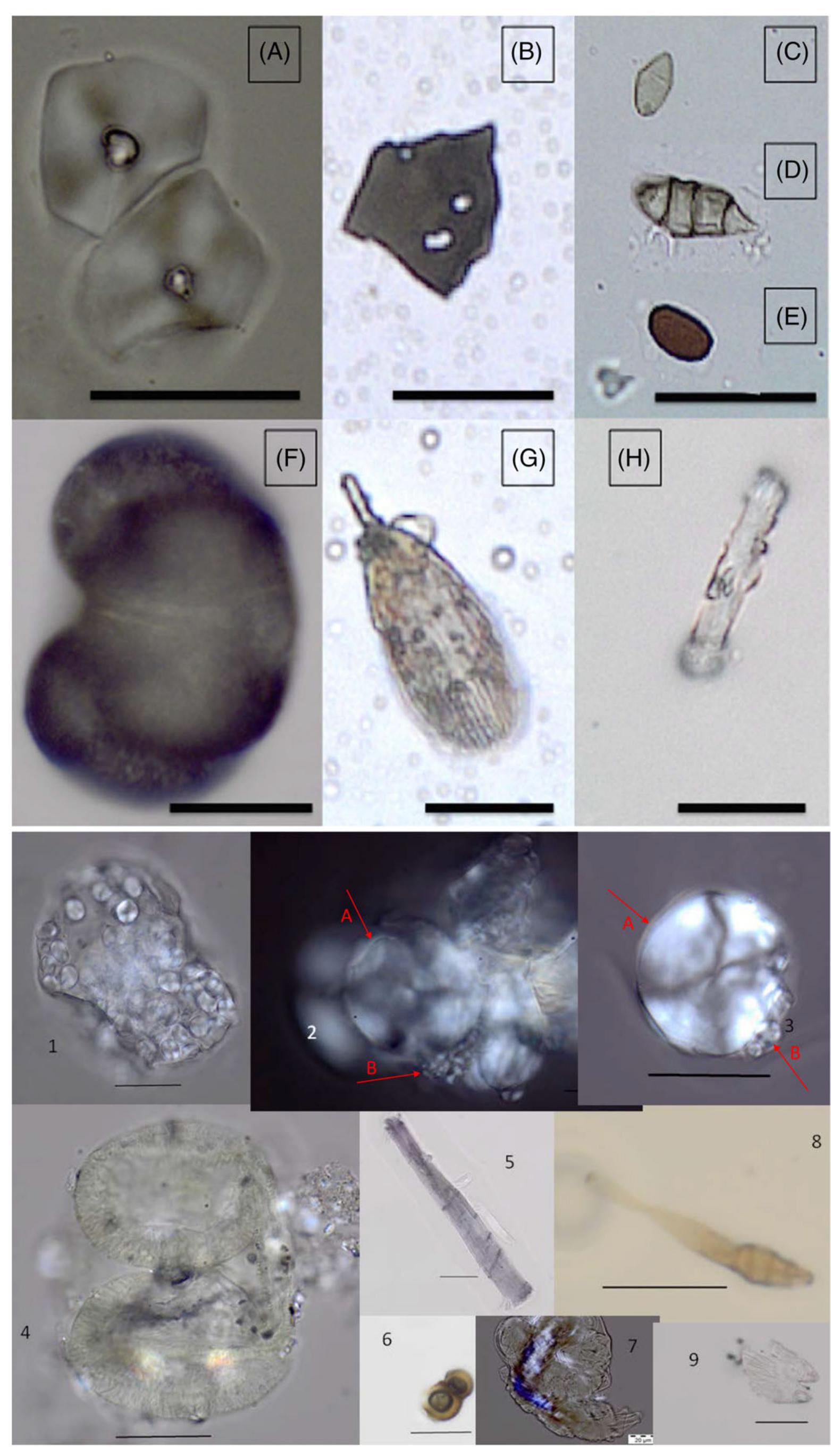 = microfossils from lower paleolithic dental calculus.