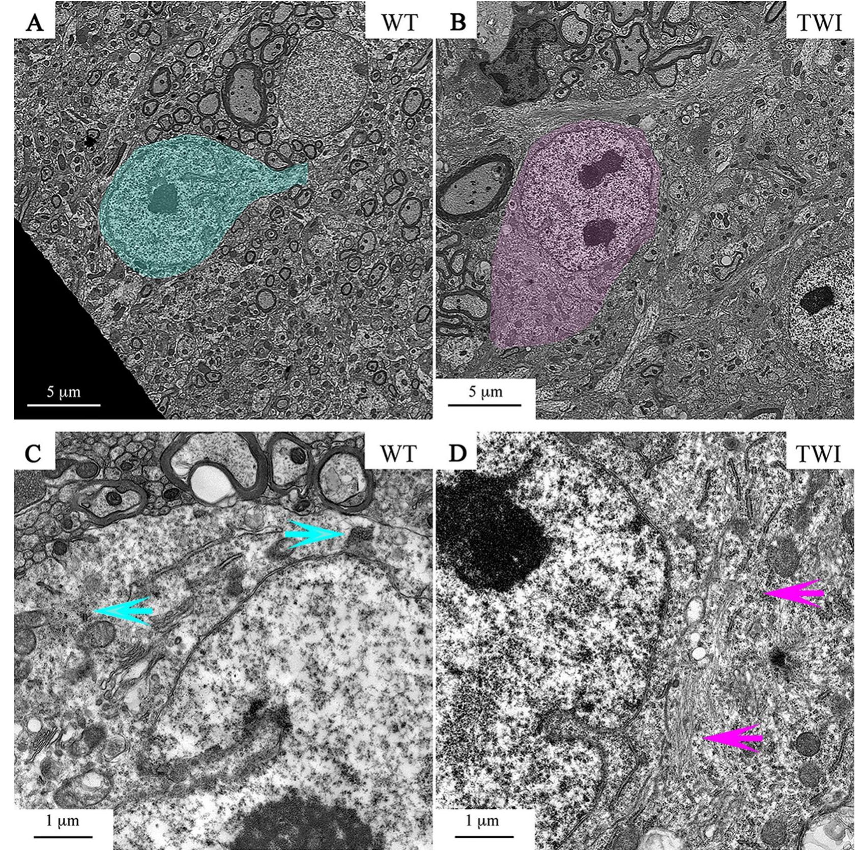 P30 motor neuron bodies in spinal cord. (a,b) mns bodies