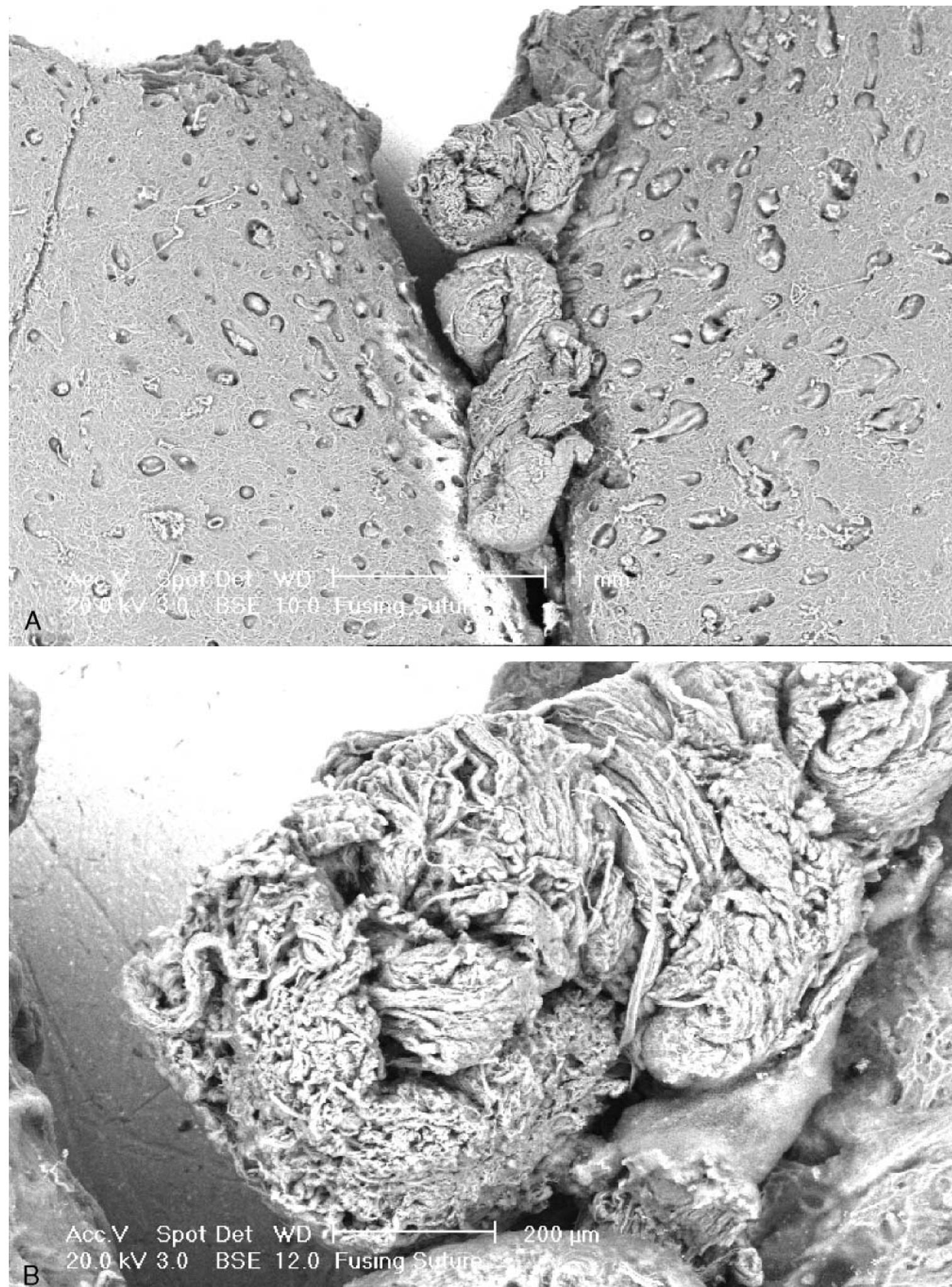 (a) a low-power scanning electron microscope secondary