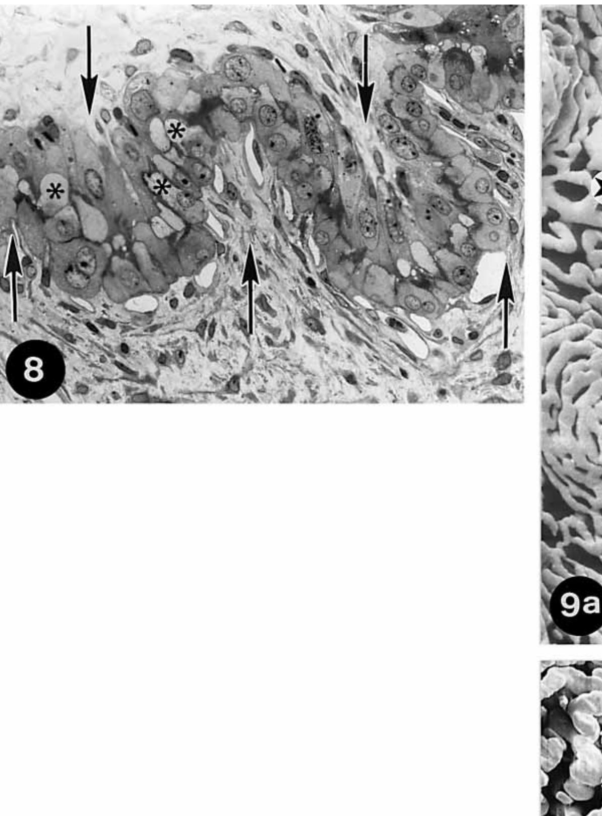 Light micrograph showing the adhesion stage and the begin-