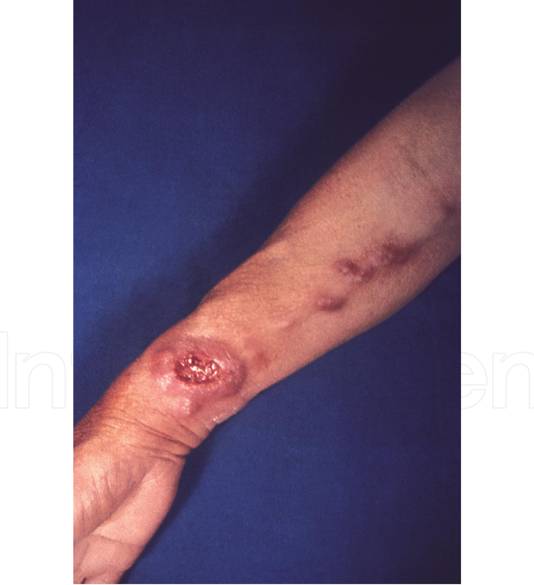 Od this photograph depicts the volar surface of a patient’s