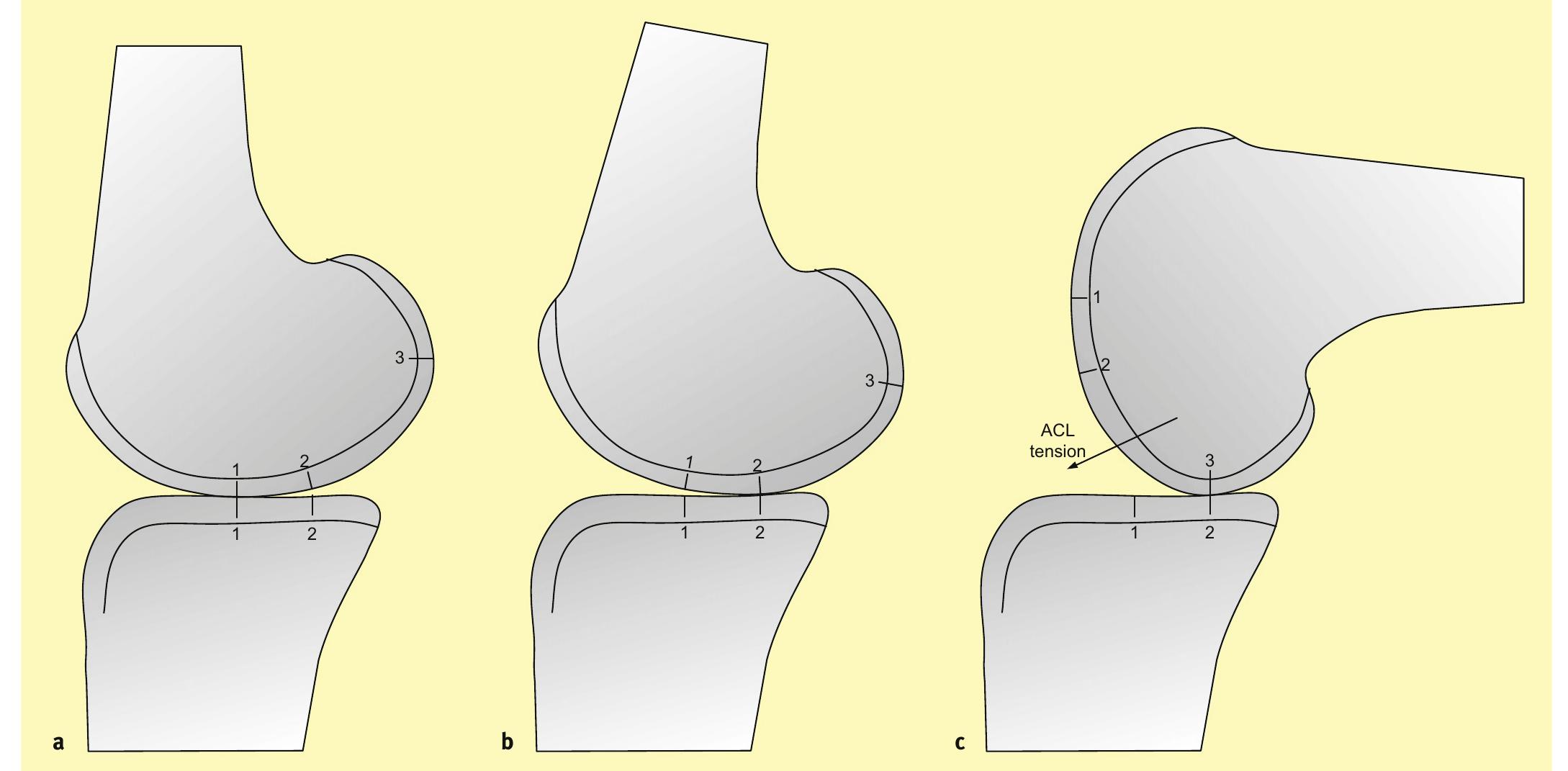 Knee joint kinematics in the sagittal plane during gait. a