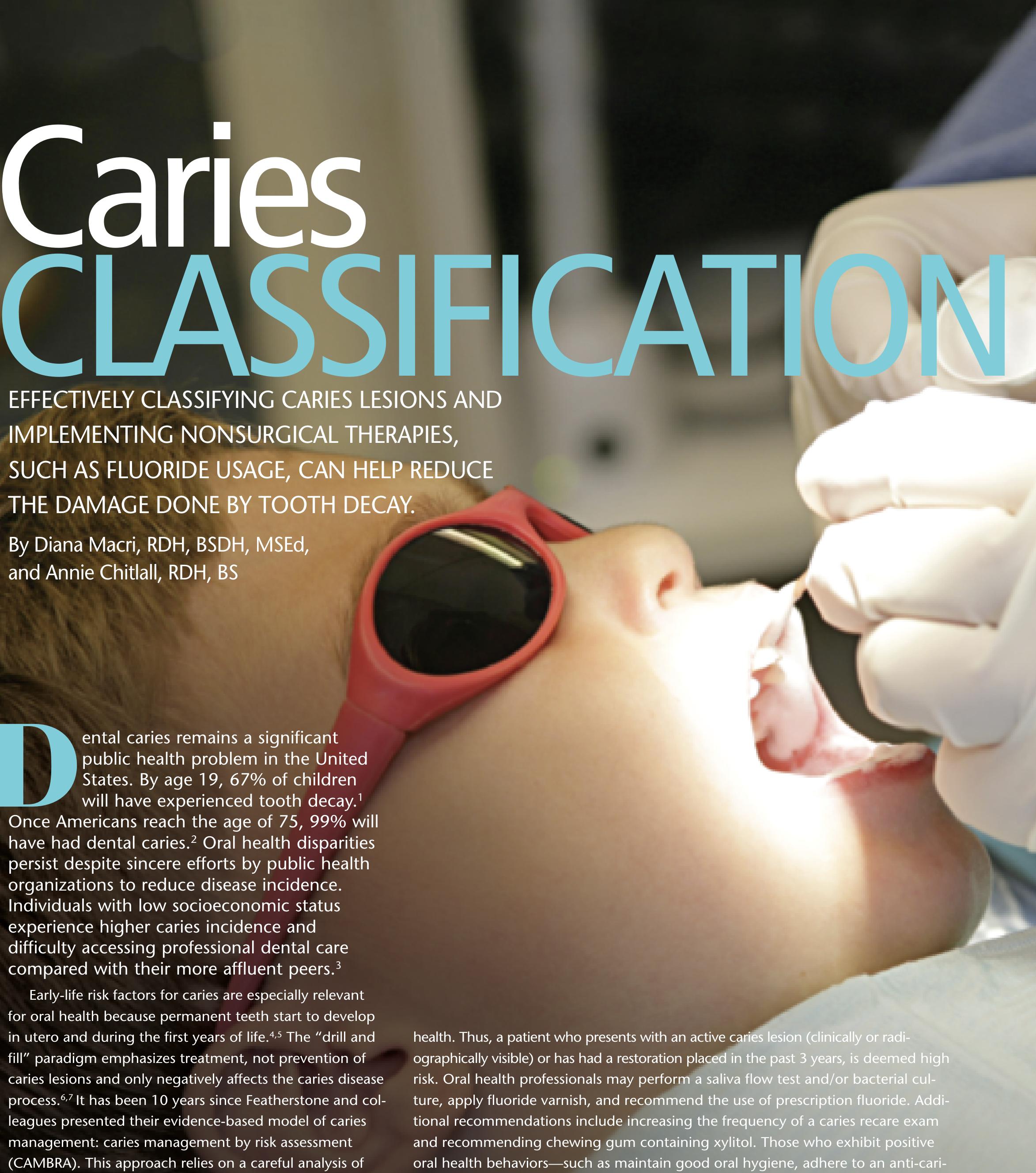 Figure 1 - Caries Classification