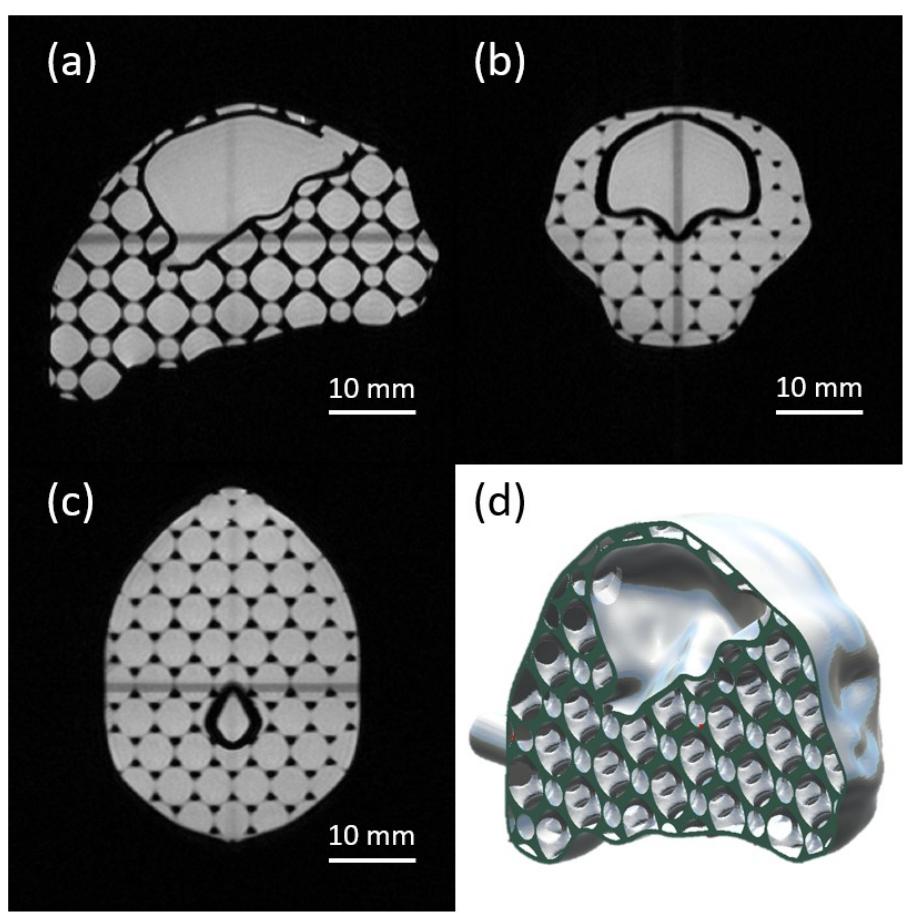 3d model and mri of head-and-brain phantom. (a-c) mr images