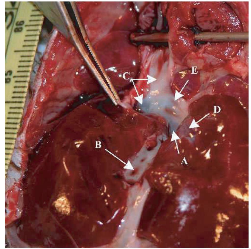 Frontal (anterior view) of the ductus venosus and central
