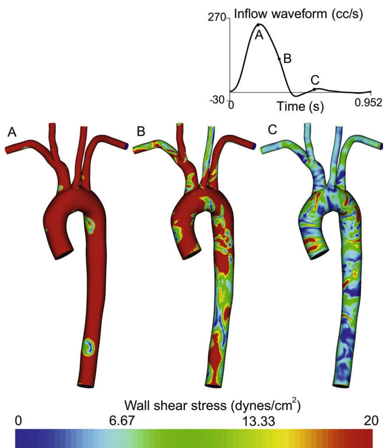 Wall shear stress at peak systole, late systole, and