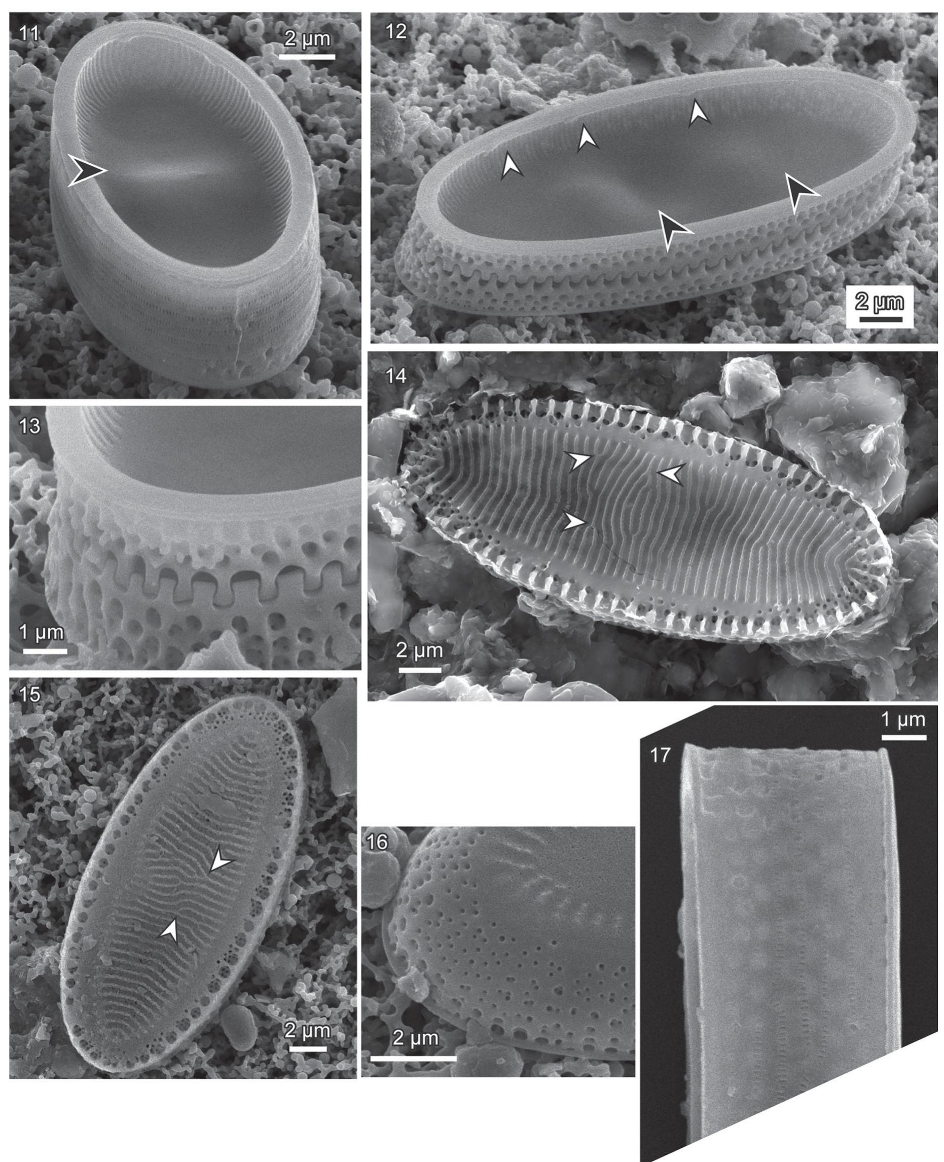 S 11-17. scanning electron microscopy (sem) images of p.