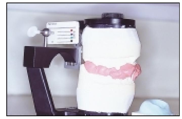 Figure 8 - from Occlusion: 3. Articulators and Related