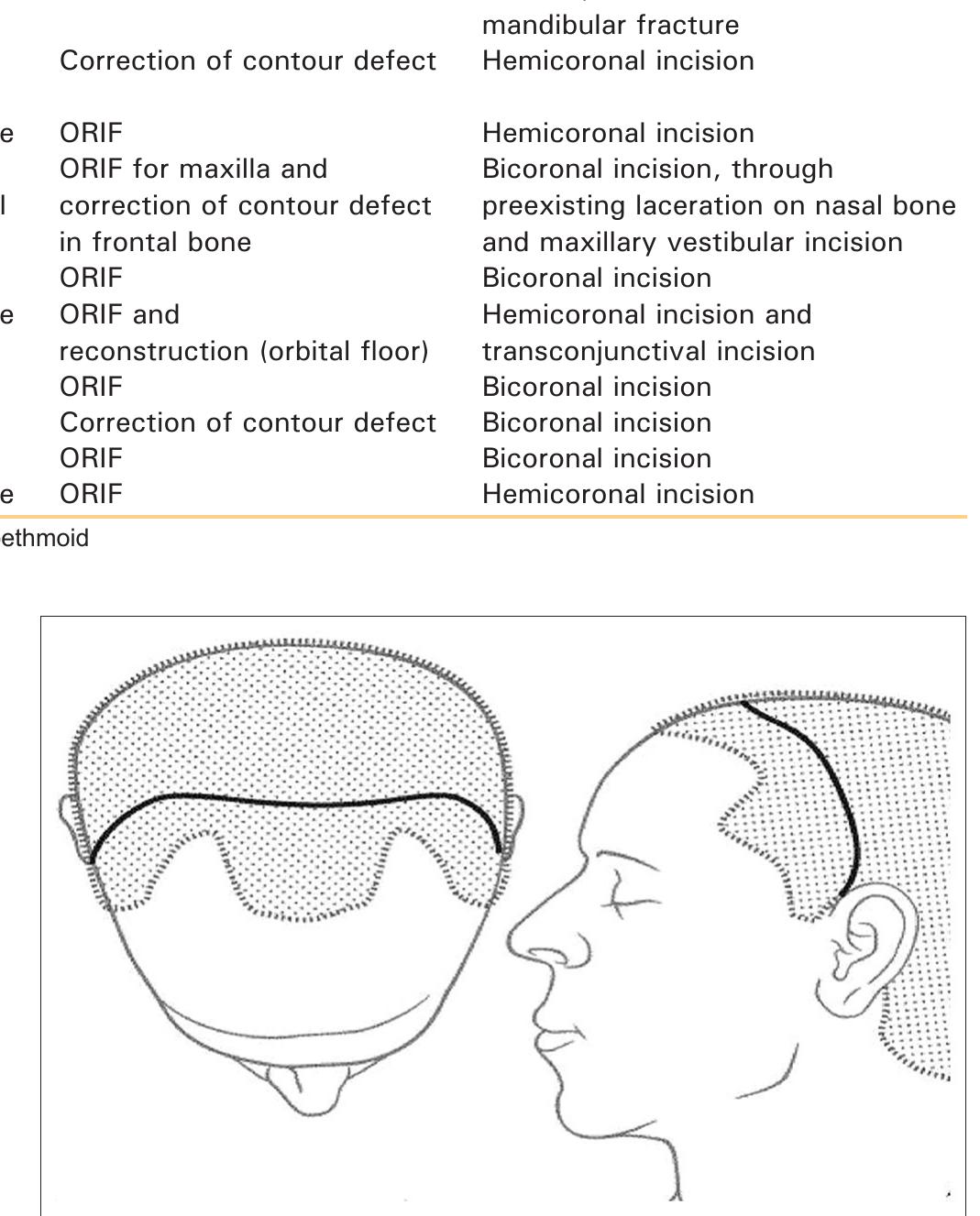 Line diagram of bicoronal incision (note the relationship of