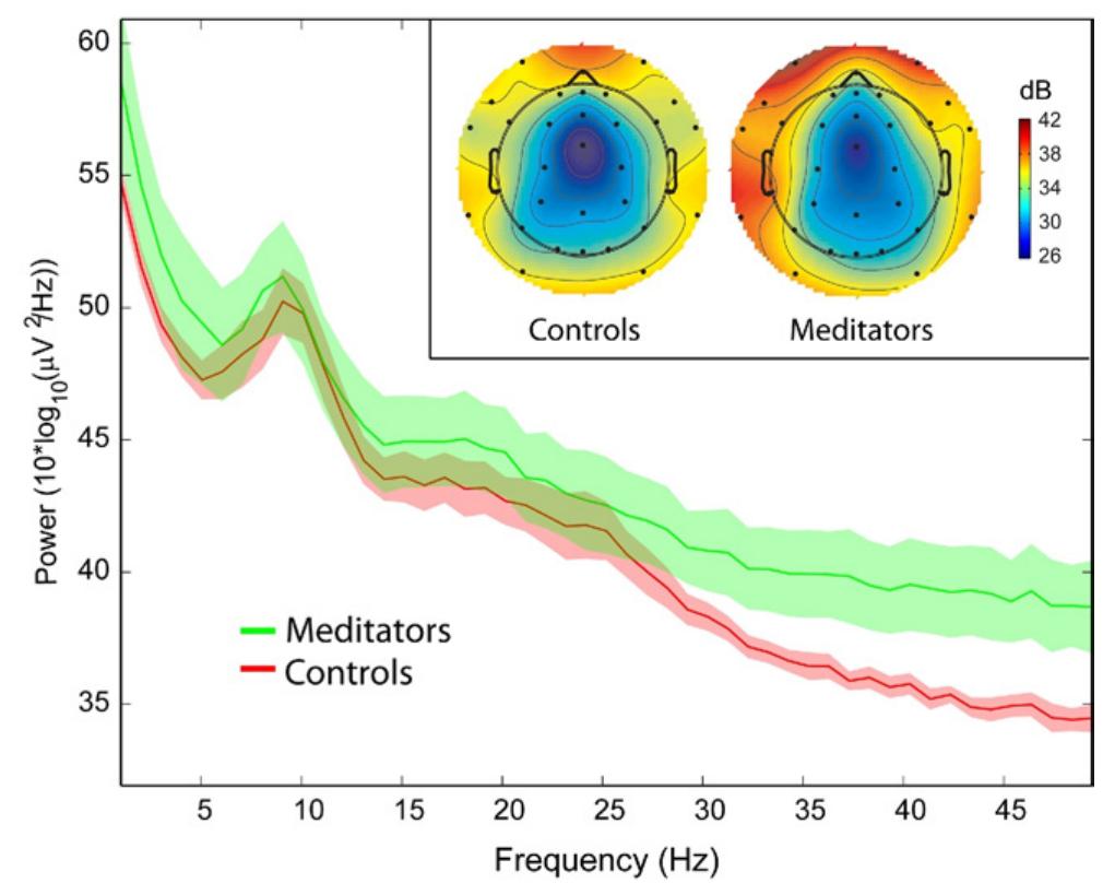 (inset) scalp maps showing spectral power scale in db for