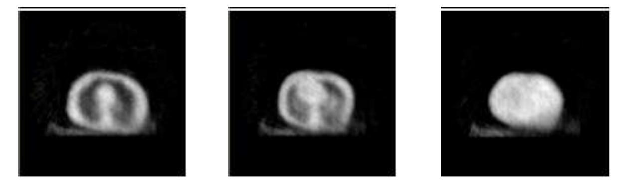 11: sample images from the attenuation map.