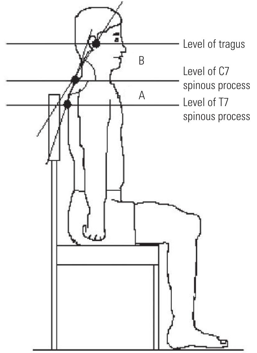 Measures of sagittal posture of cervical and thoracic spine.