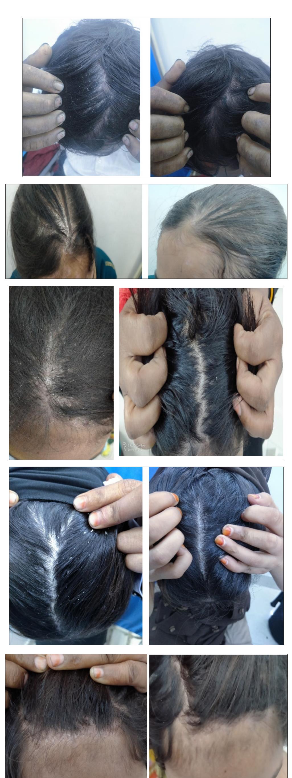 Acknowledgement figure | .photographs of patients before and