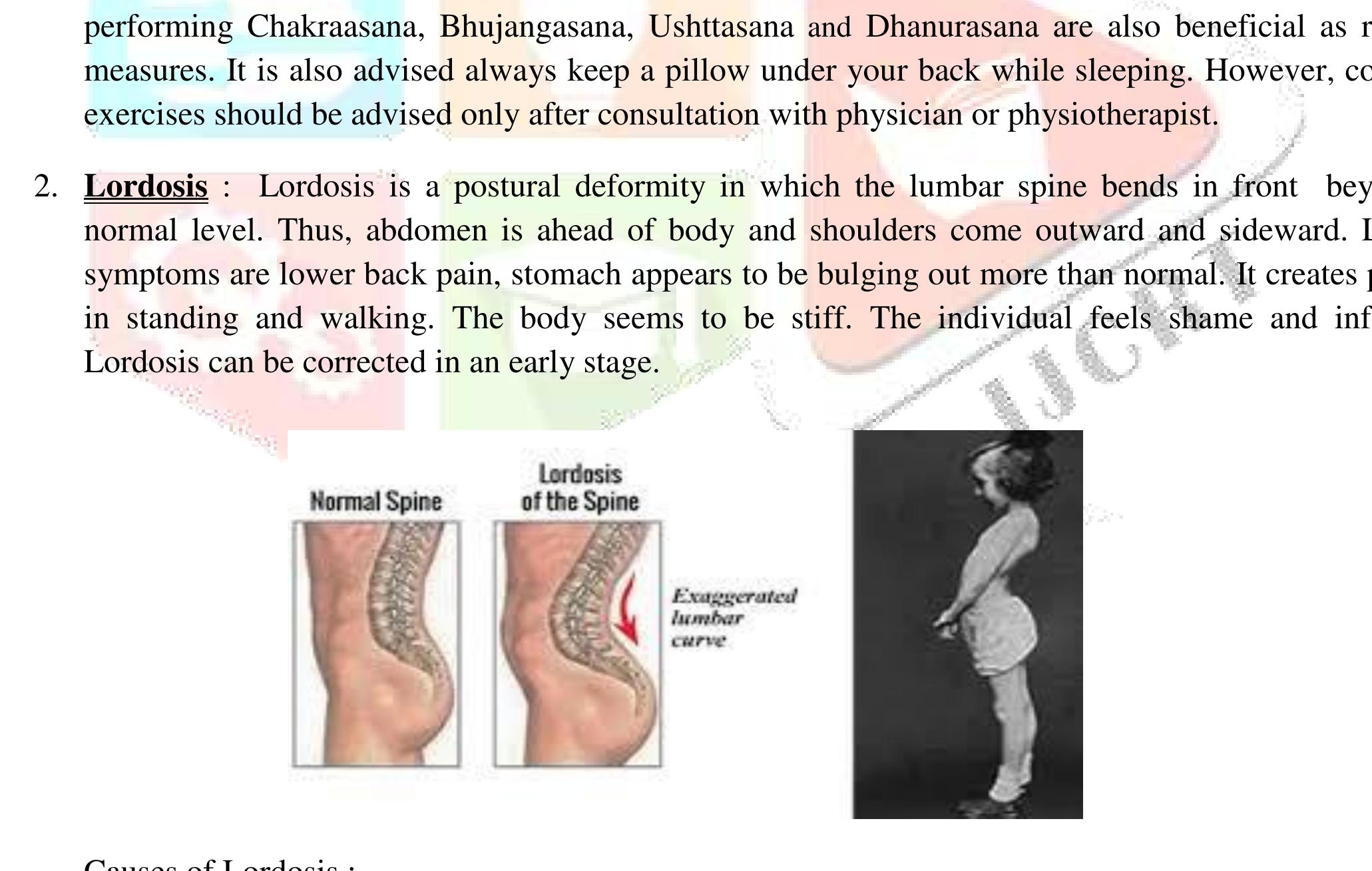 Figure 2 - Common Postural Deformities and Its Remedial