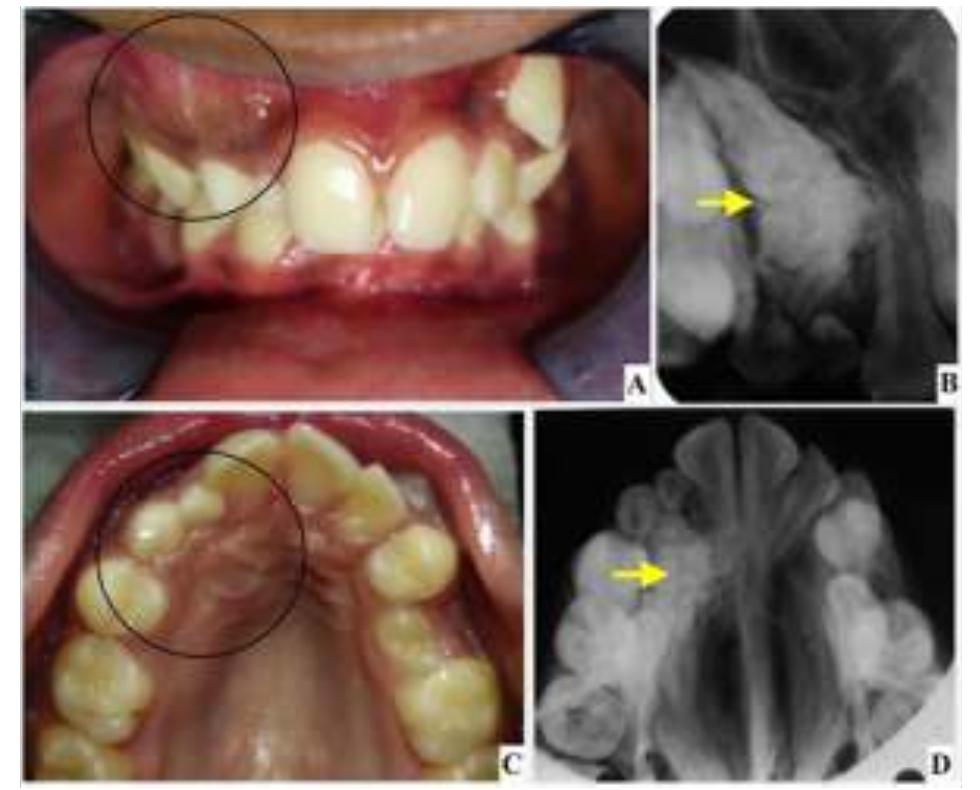 Preoperative intraoral photographs and radiographs 1a.