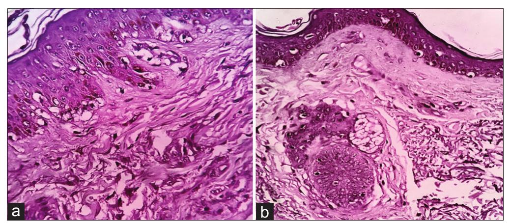 Photomicrograph showing the h & e staining of skin processed
