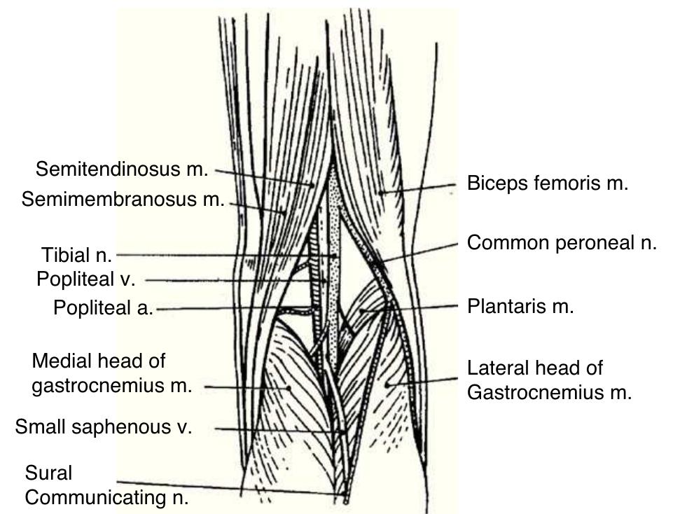 A simple drawing of the popliteal fossa. baker cysts occur