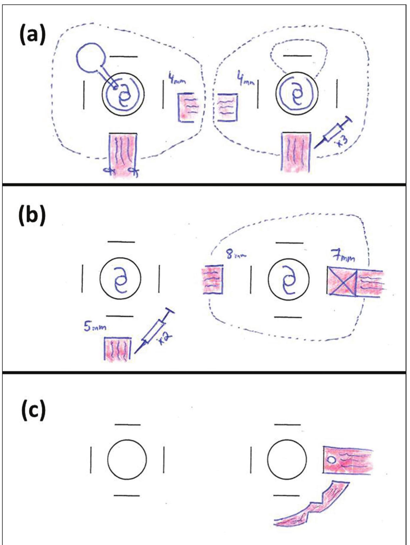 C. examples of preoperative surgical history templates of