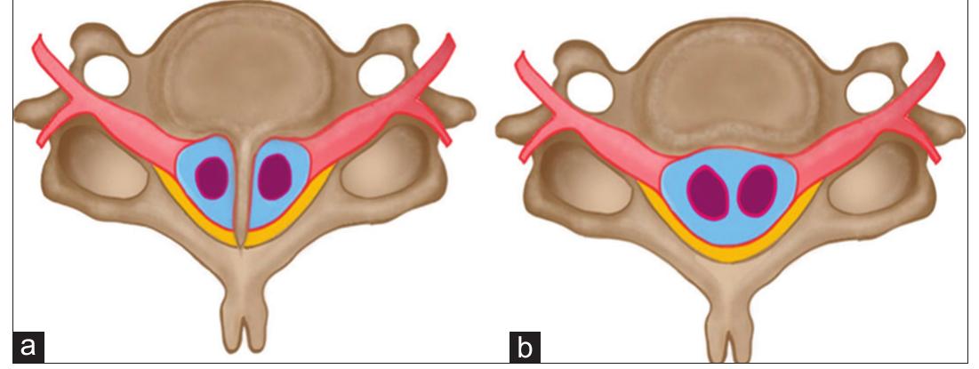 Graphical illustration demonstrating the two types of scm