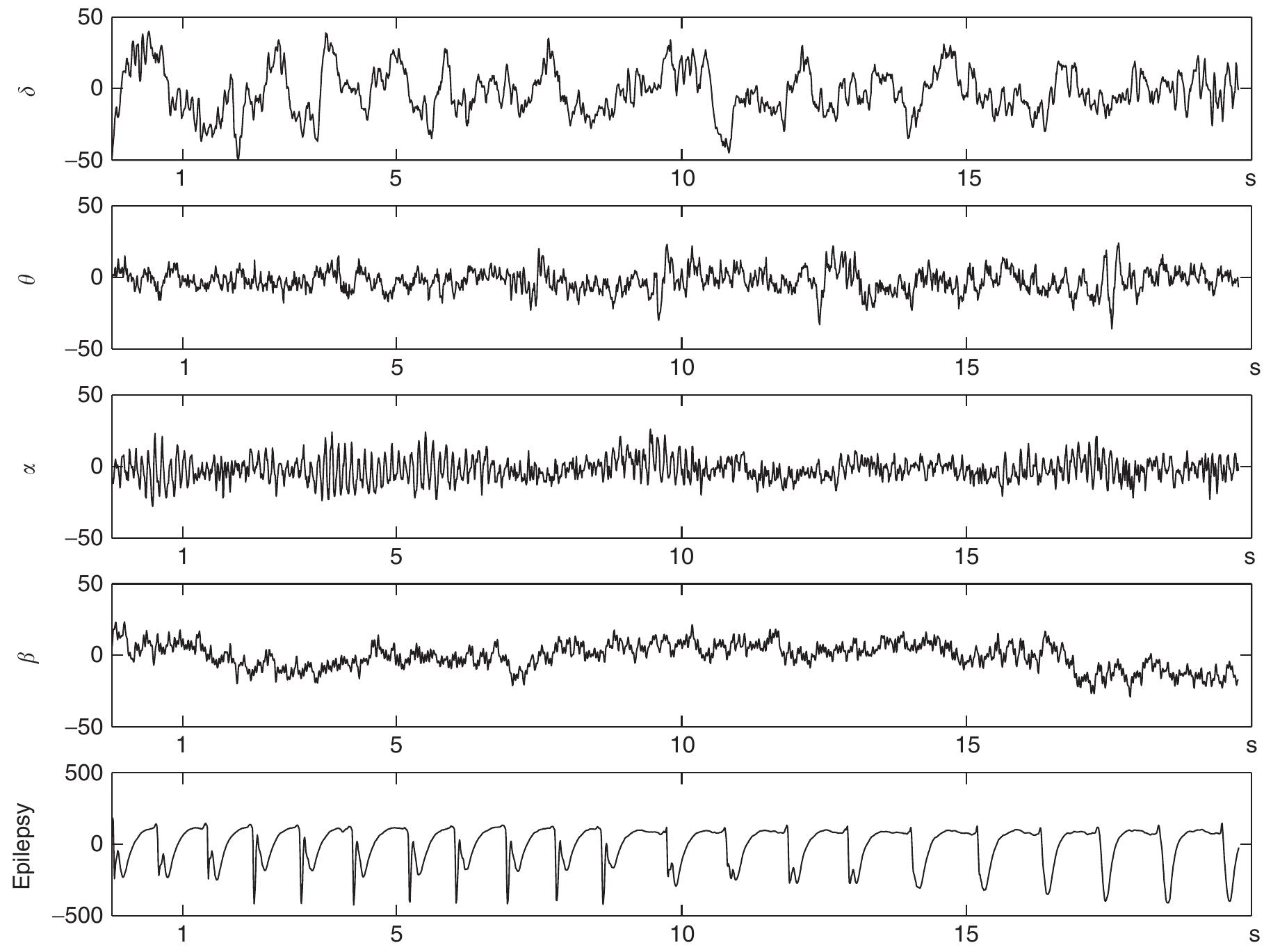 (PDF) Electroencephalography (EEG)