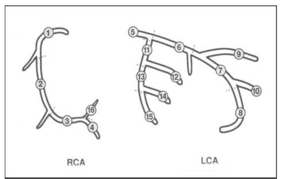Segmental anatomy of the coronary arteries after a modified
