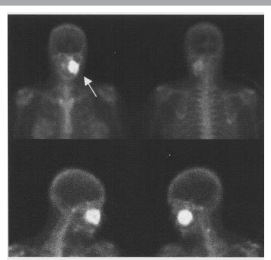 Anterior, posterior, and right and left lateral views,
