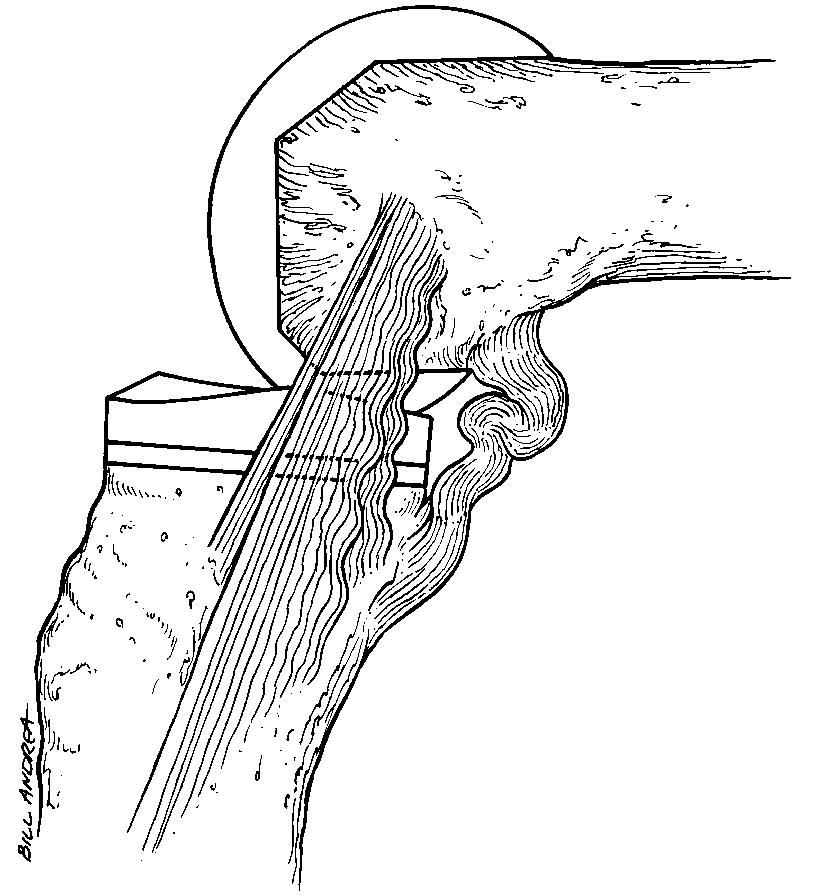 Drawing of the medial side of the knee in a flexed position