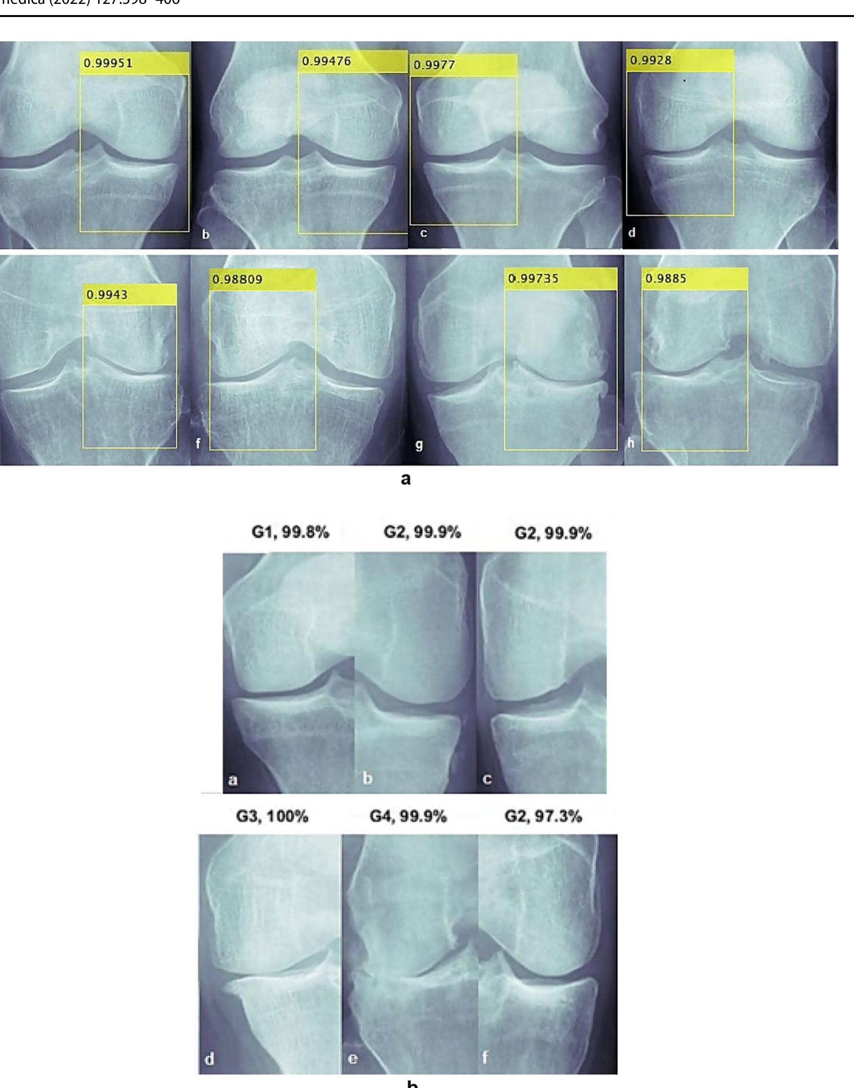 A examples of roi detection. a-h minimal knee joint space