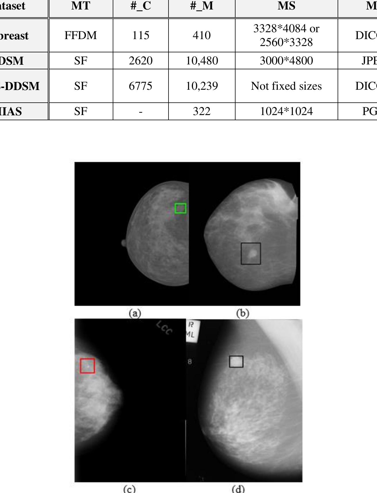 Datasets samples with their ground truth; (a) a mammogram