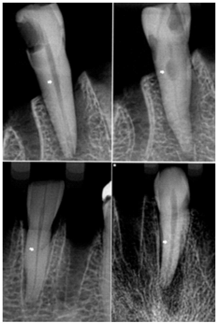 Digital radiographic images showing examples of simulated