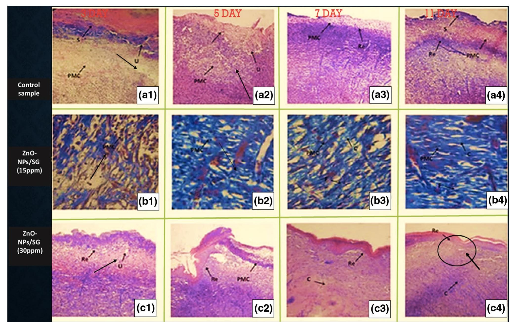 Optical microscopic images of the mouse skin wound healing