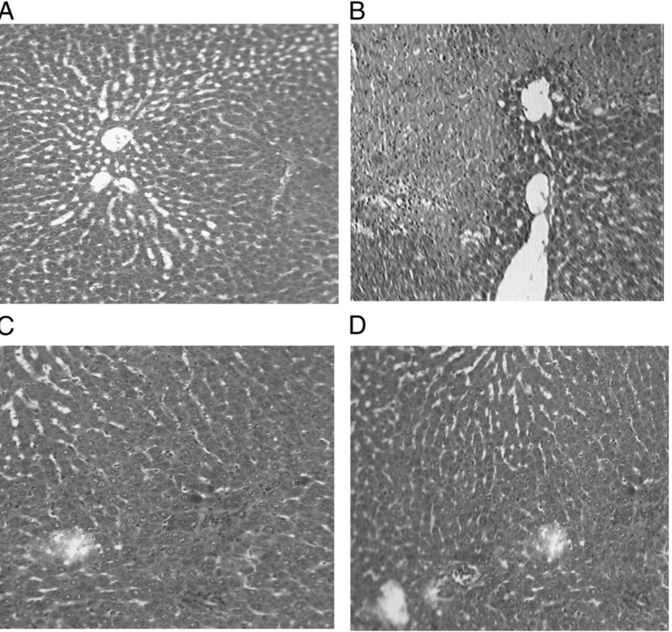 Liver histology after hepatic ischemia-reperfusion (ir)