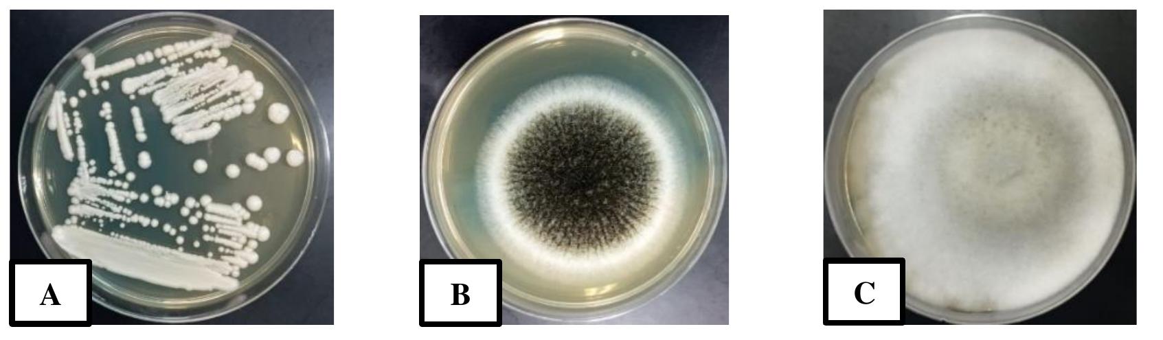 Fungal culture on sabouraud dextrose agar a. candida sp, b.