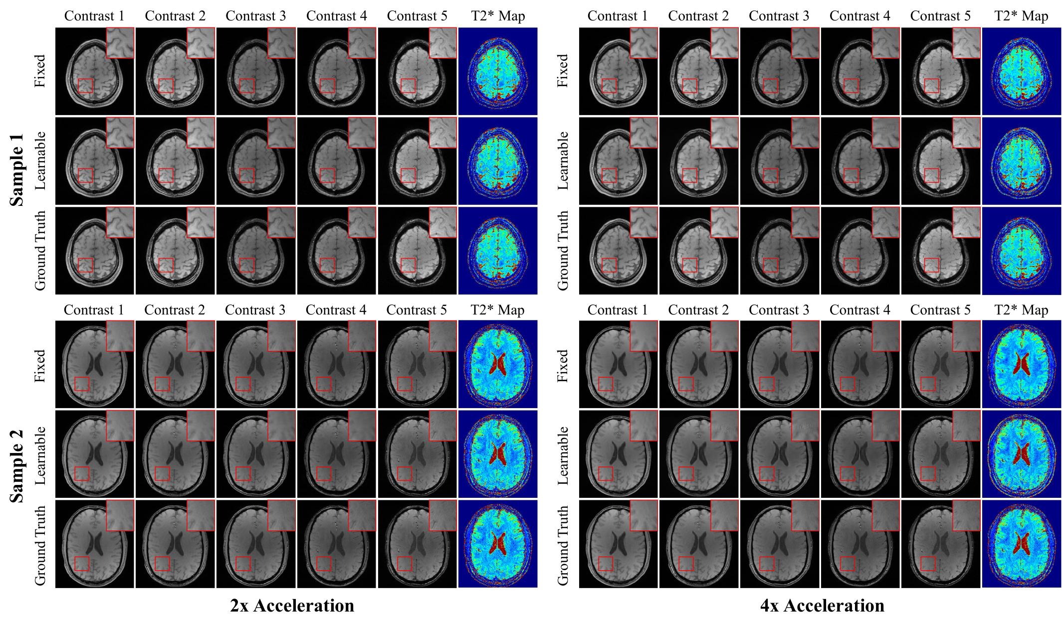 The reconstructed images and the synthesized t2* maps based